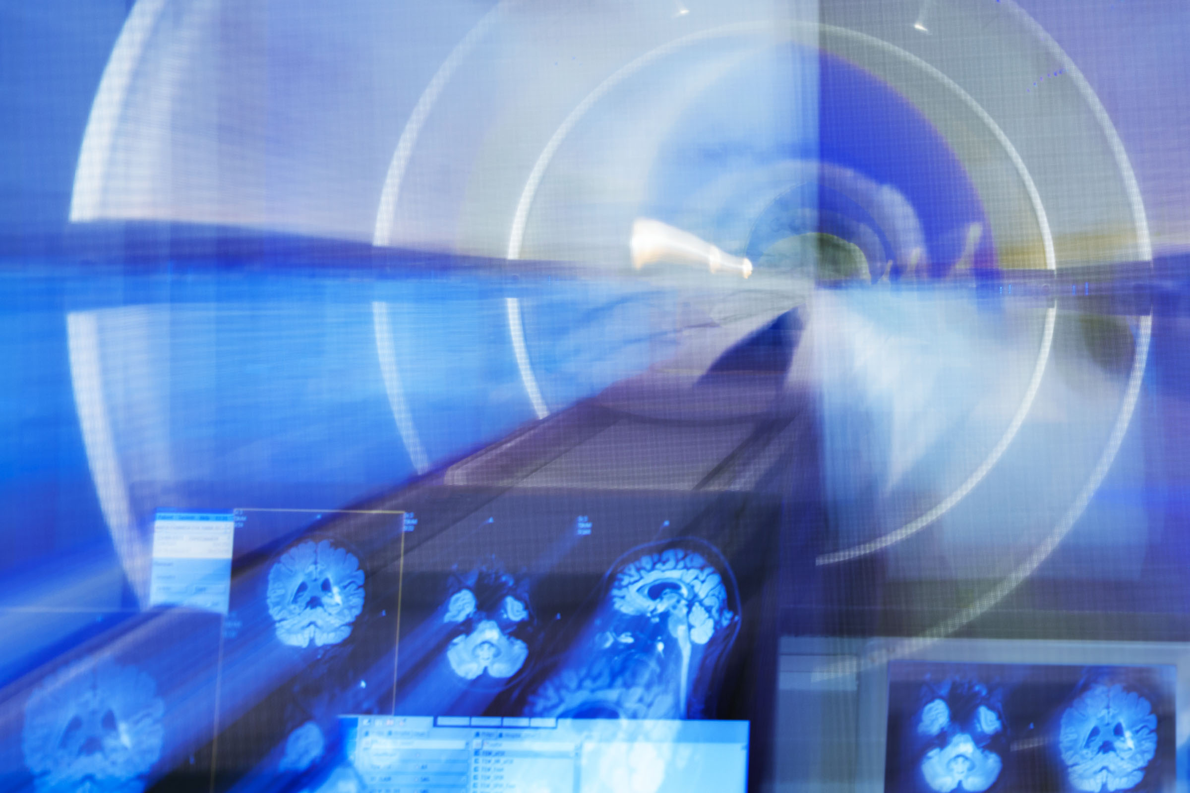 RaPIDの読影サービスとは？ | 株式会社RaPID