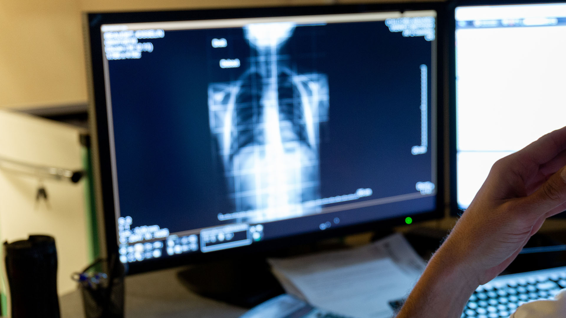 読影サービス | 株式会社RaPID